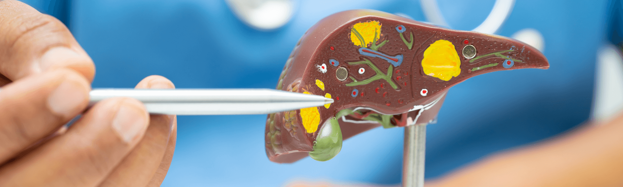 NAFLD/MASLD Patient Journey Research - Cetas Healthcare